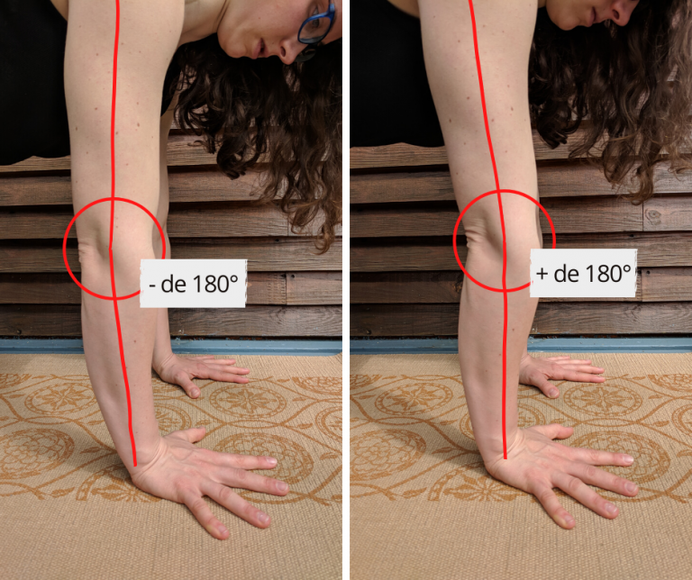 L’hyperextension du coude - Sama, yoga et méditation